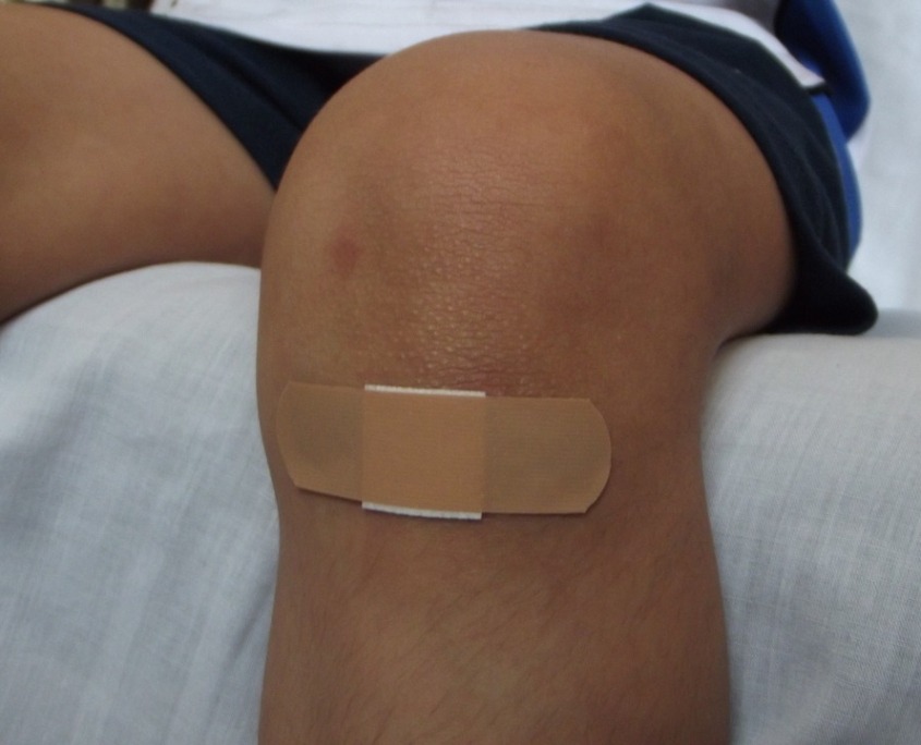 Slagaderlijke bloeding | Een gevaarlijk soort bloeding - Bloedcellen